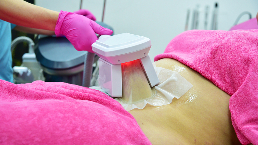 Articles | What to Expect From Your First Non-Surgical Fat Reduction ...