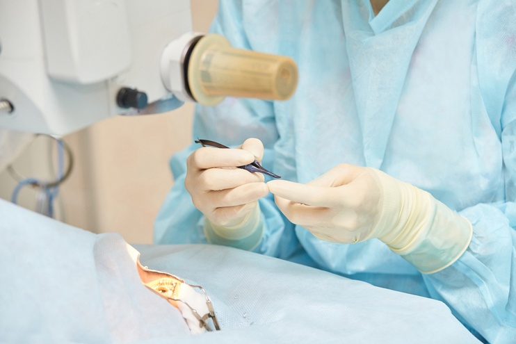 When Is the Right Time for Cataract Surgery? Your Complete Guide