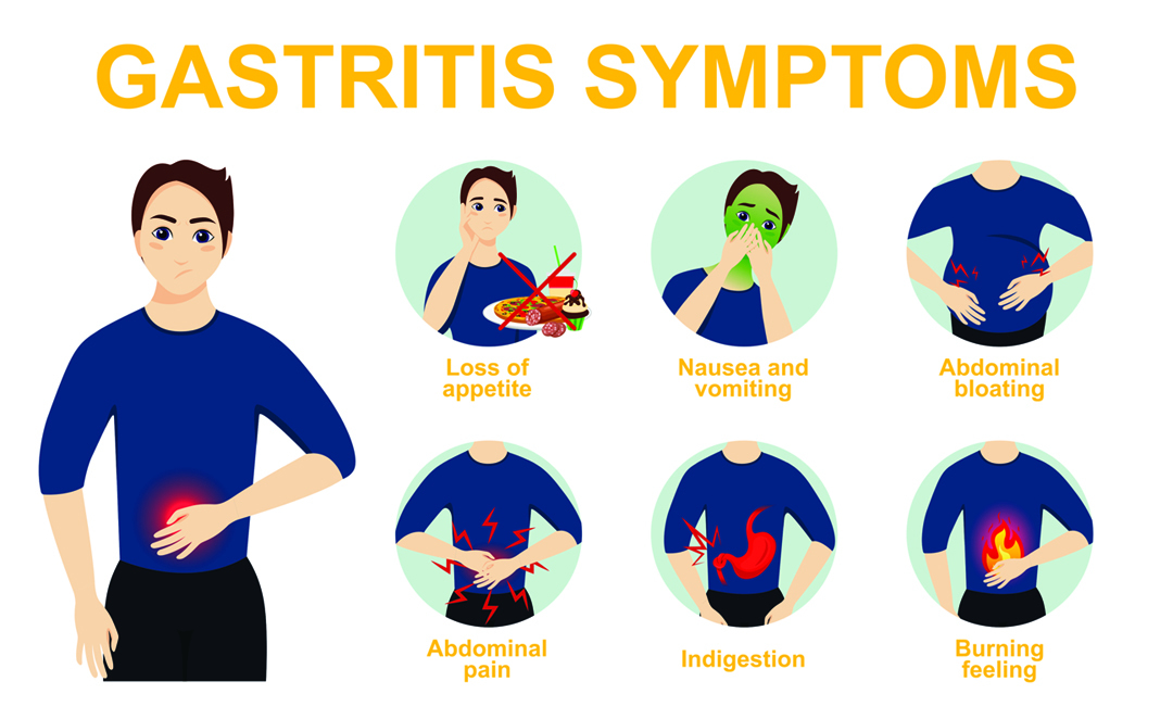 Gastrite Sintomas Sintomas E Causas Da Gastrite Google Slides E