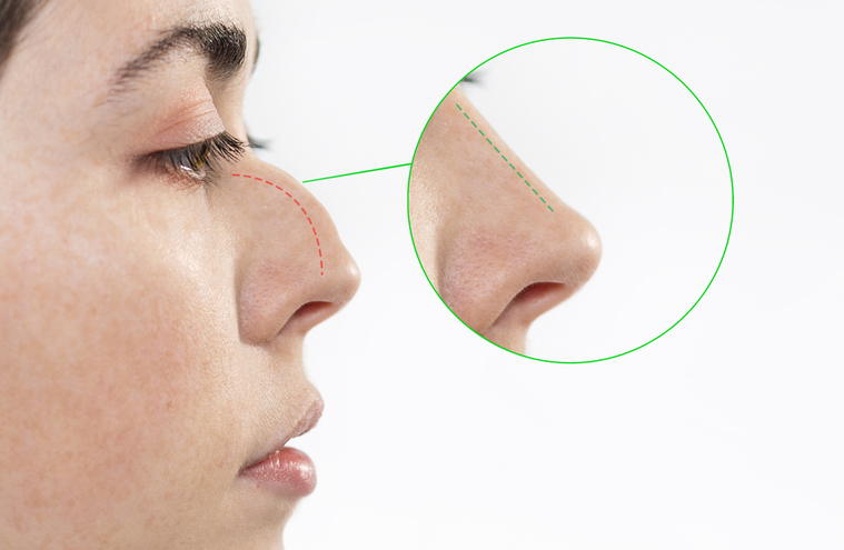 Long curved nose store