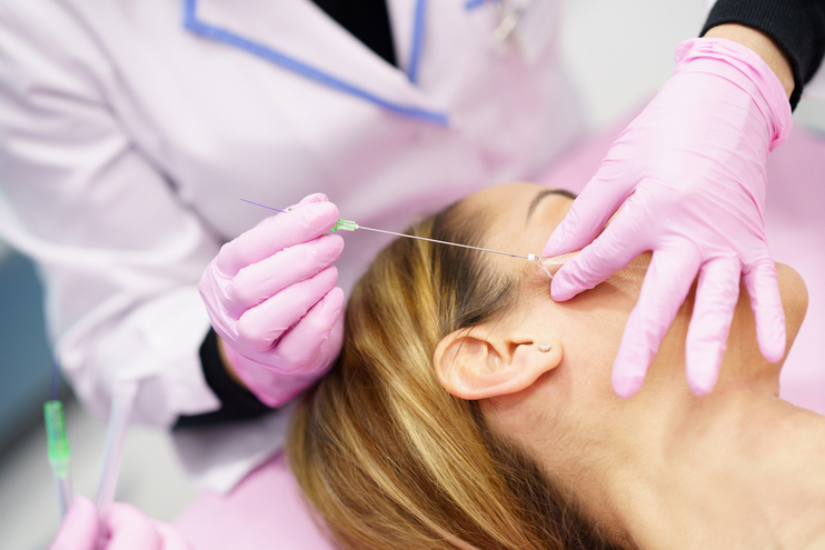 PDO Thread Lift vs. Traditional Facelift: Which Is Better for You?