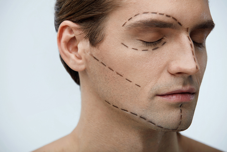 Articles | Why More Men Are Getting V-Line Treatments