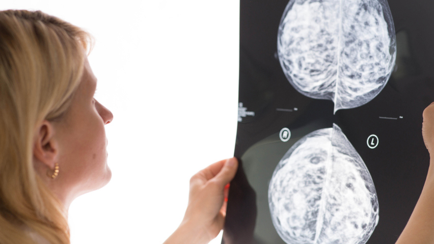 Articles | The Importance of Post-Operative Care in Breast Augmentation ...