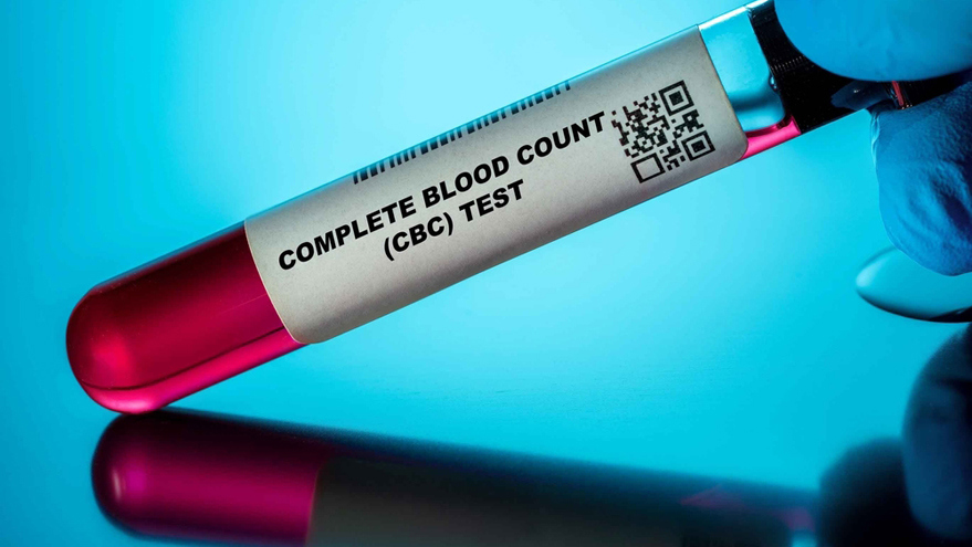 Articles | What Your Complete Blood Count (CBC) Results Really Mean