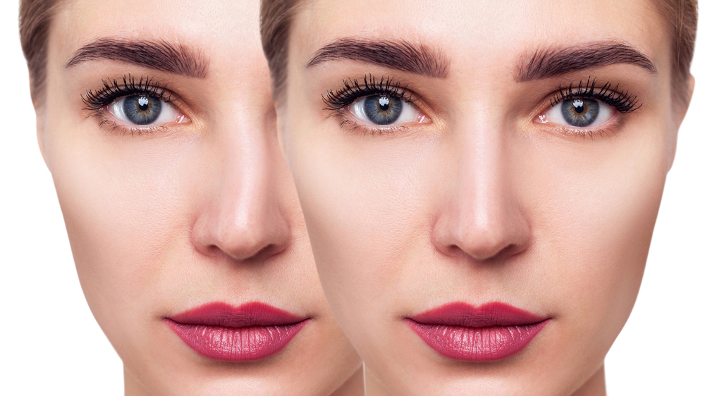 Articles | Crooked Nose Correction: How Rhinoplasty Achieves Symmetry
