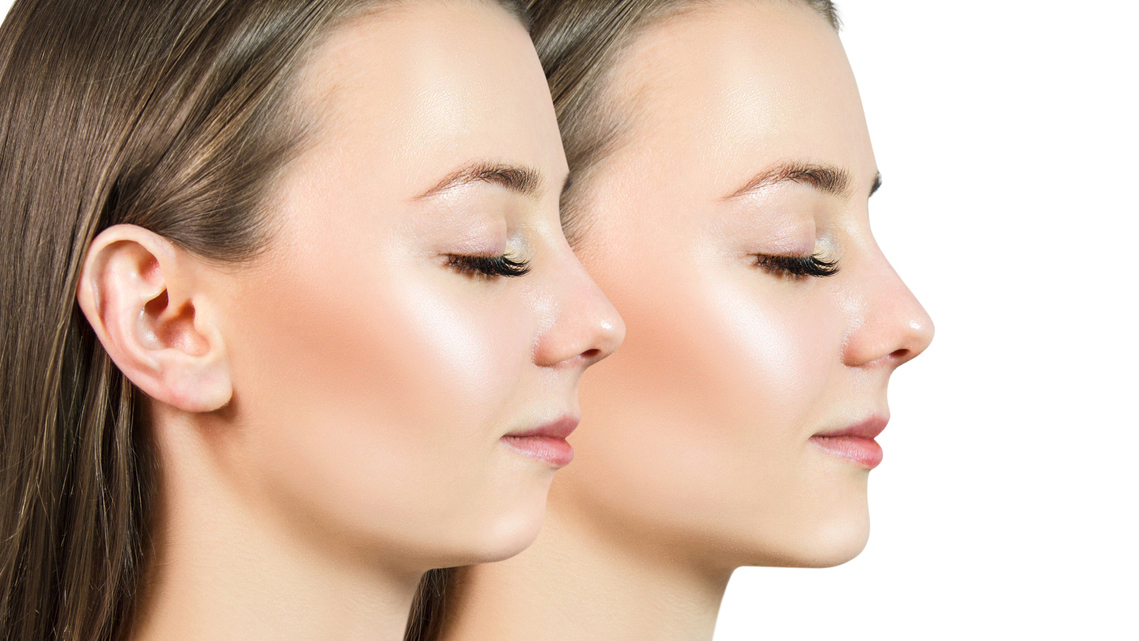 Articles | Mini Facelift for Mild Sagging: Best Age to Consider Treatment