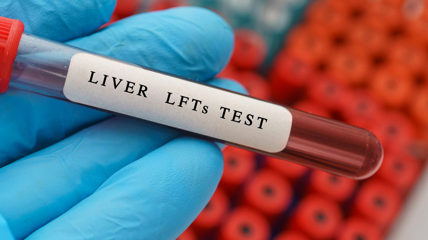 Articles | The Importance of Routine Liver Function Tests – What They ...
