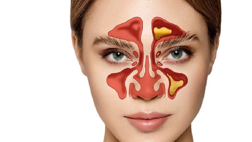 Articles | Chronic Sinus Congestion: Causes, Symptoms, and Advanced ...
