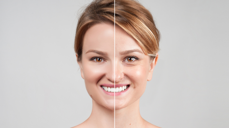 Articles | Secret Laser Treatment for Youthful Skin at BLS Clinic