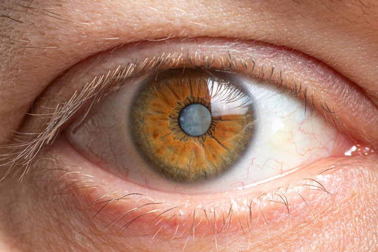 Articles | Could IOL Implants Be the Key to Regaining Your Clear Vision ...