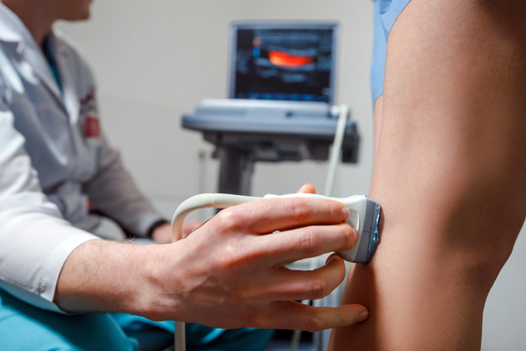 How Doctors Use Ultrasound to Map Your Vein System