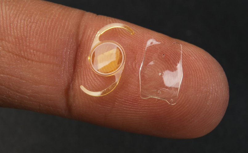 How to Choose Between Monofocal, Multifocal, and Toric IOL Implants