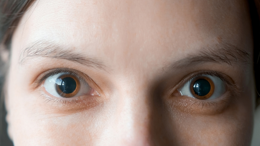 Artikel | Bisakah Anda Melakukan LASIK Jika Memiliki Pupil Besar ...