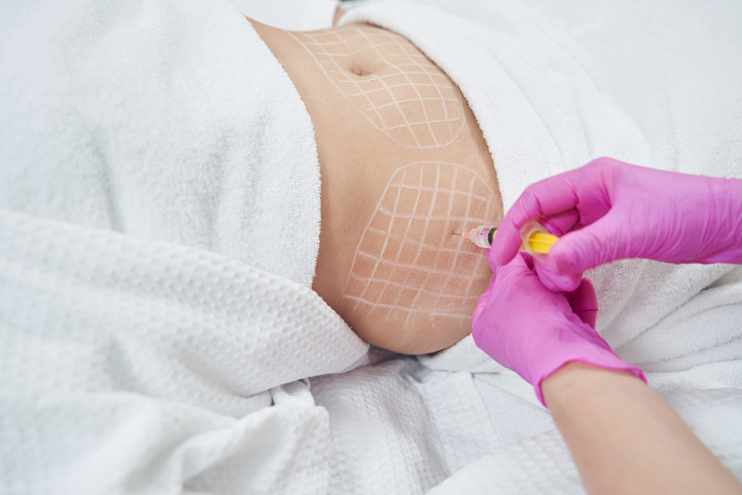 Articles | Body Fat Dissolving Injections: Benefits & Aftercare
