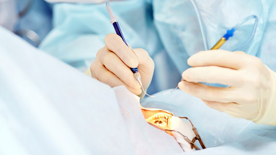 Articles | Cataract Surgery After LASIK, PRK, SMILE: Risks & Solutions