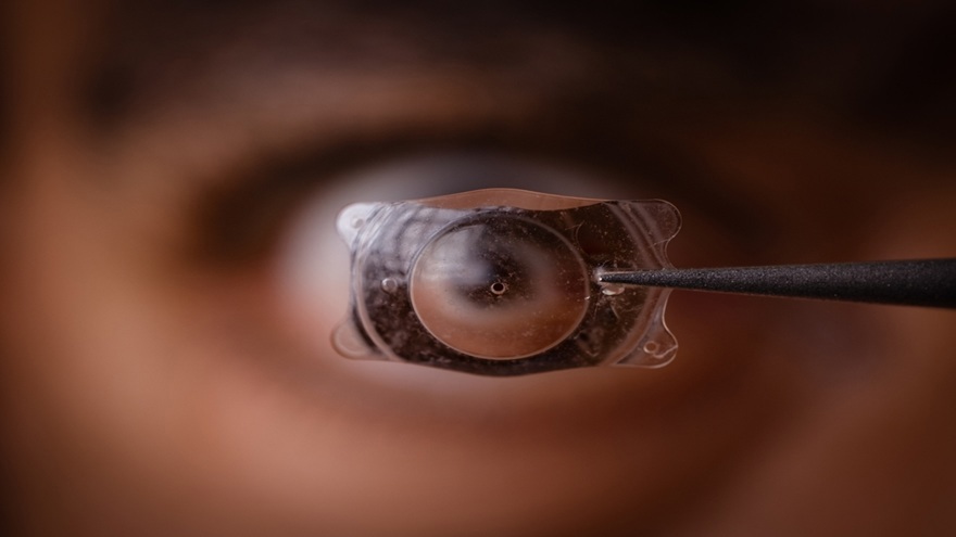 Articles | Toric Lens Implants vs. Traditional Lens Implants: What’s ...
