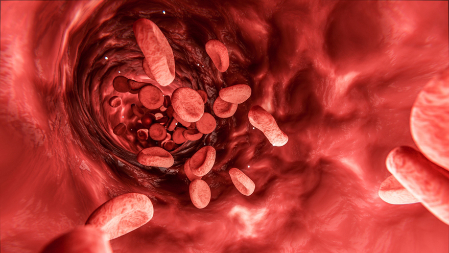 Articles | How Do Varicose Veins Affect Your Circulation and Overall ...