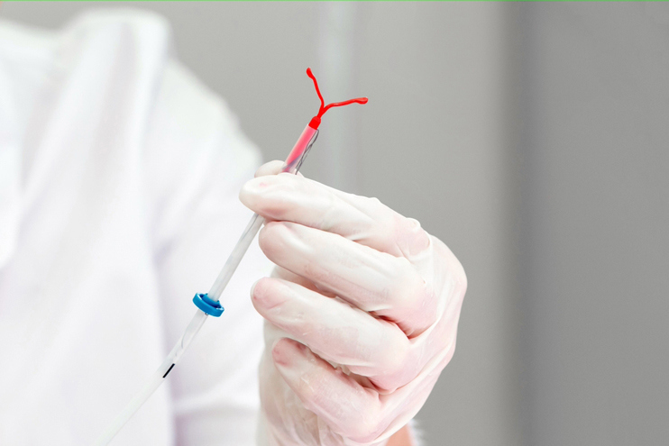 IUD vs. Implant: Key Differences Explained
