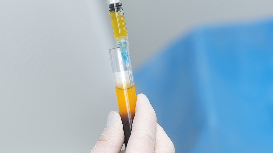 Articles | PRP Eye Treatment: Breakthrough in Eye Health Recovery