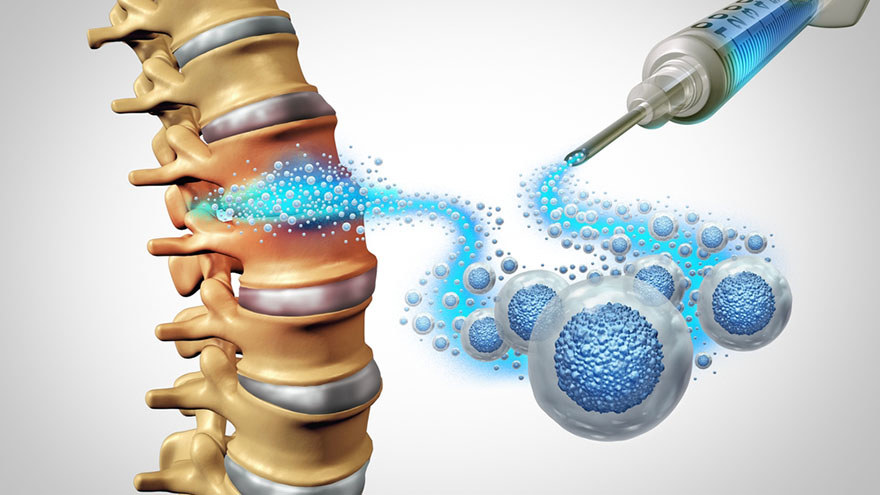 What to Expect When Using Stem Cells for Brain and Nerve Regeneration