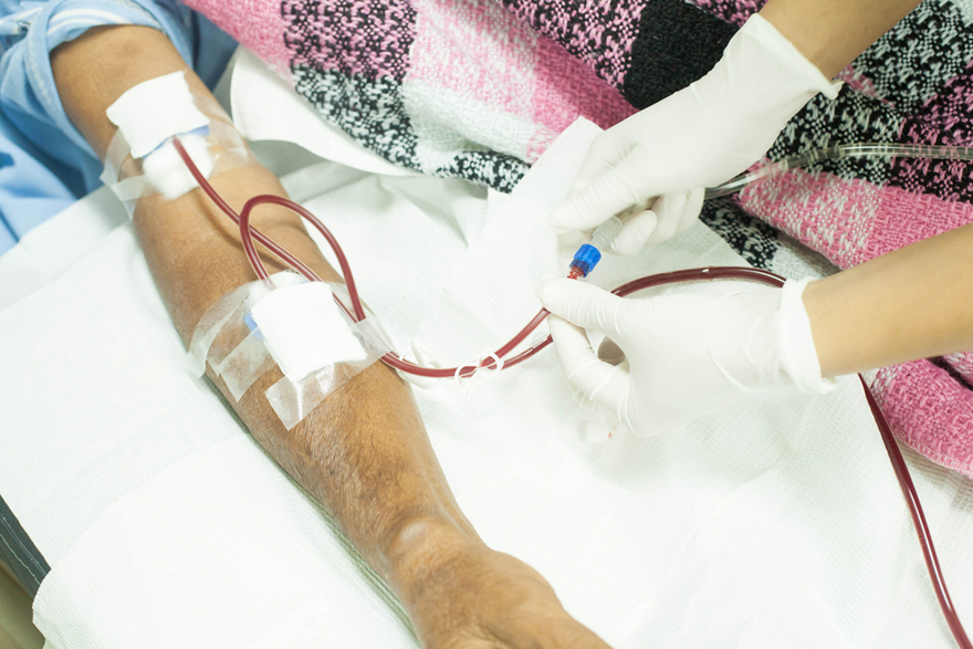 Articles | Early Warning Signs of AVF Failure You Shouldn’t Ignore