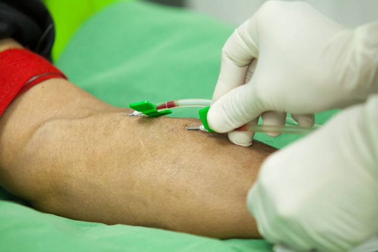 Articles | What Are the Risks and Benefits of Dialysis Access Surgery?