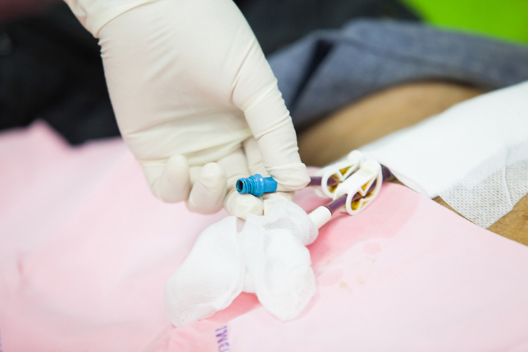 Articles | Why Regular Monitoring of Dialysis Access Sites Is Crucial