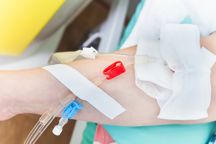 Articles | What to Expect in the First Few Weeks After Dialysis Access ...