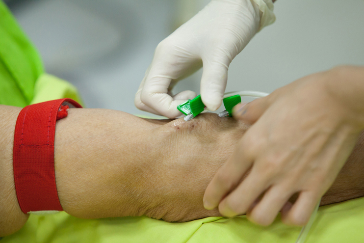 Articles | What Is the Process of Creating an Arteriovenous Fistula ...