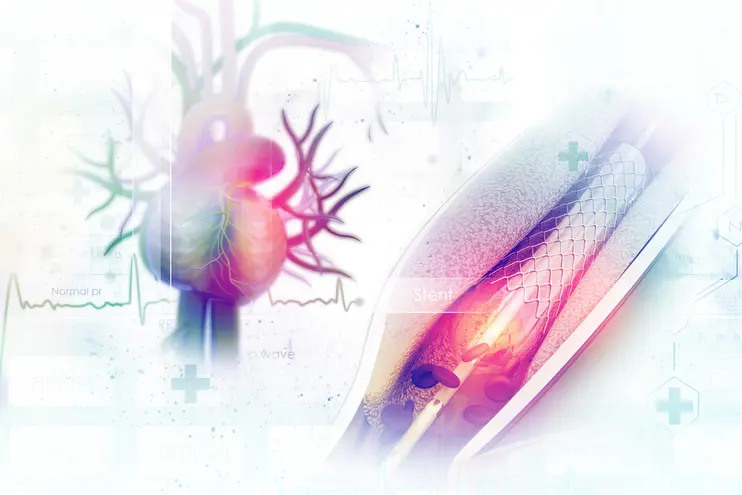 Rotational Atherectomy Procedure