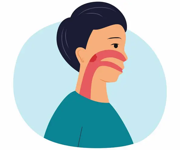 Cirugía endoscópica de adenoides