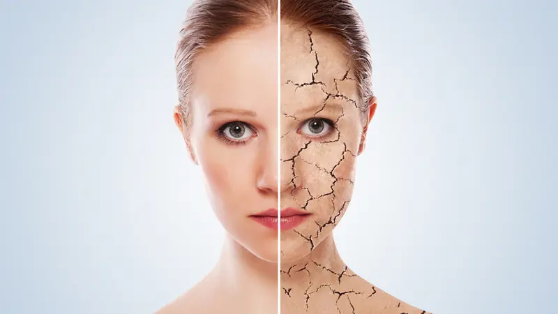Dry Skin (Xerosis): A Complete Guide to Causes, Symptoms, and Treatment ...