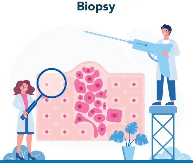 Biopsy Testing and Diagnosis