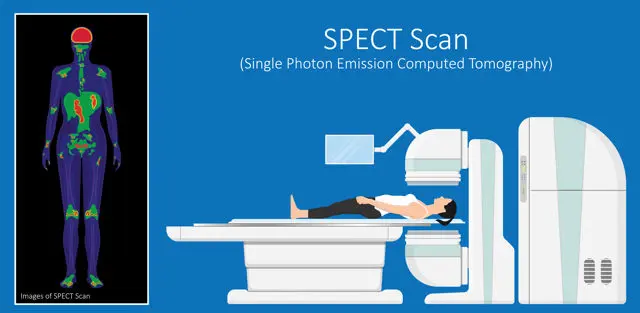 Cardiac SPECT Imaging