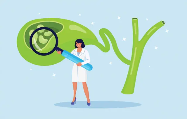 Gallbladder Disease: Expert Insights and Key Facts Patients Need