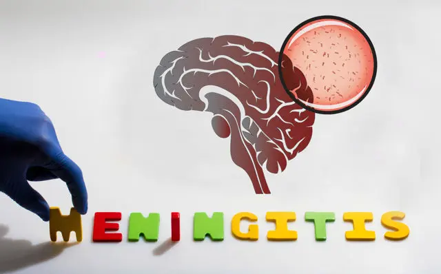 How Could Meningitis Change Your Life Forever