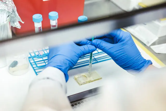 ZyMot Sperm Sorting Technology