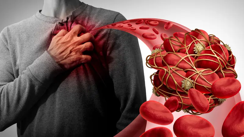 Antithrombin Deficiency: A Complete Guide to Causes, Symptoms, and ...