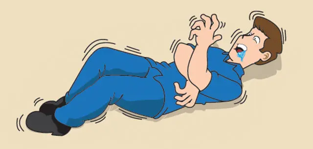 Seizures Explained: Causes, Symptoms, and Treatment Options