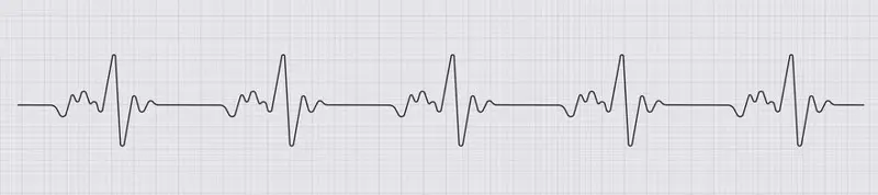 ASD Closure with Device