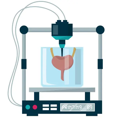 Artificial Bladder Implant Surgery