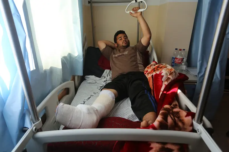 Limb Reconstruction Surgery