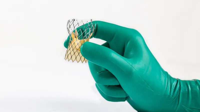 Double Heart Valve Replacement Surgery