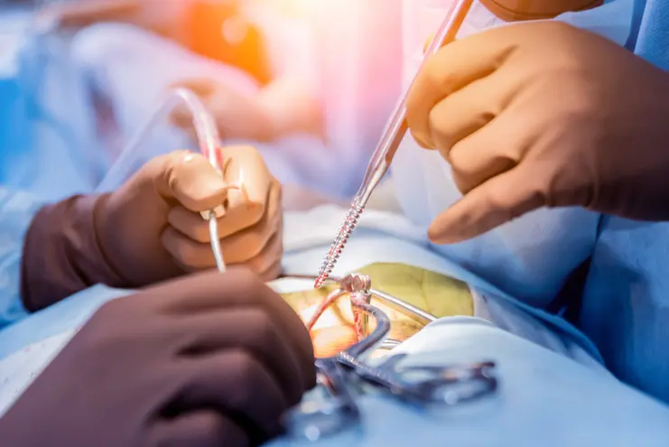 Open lumbar discectomy