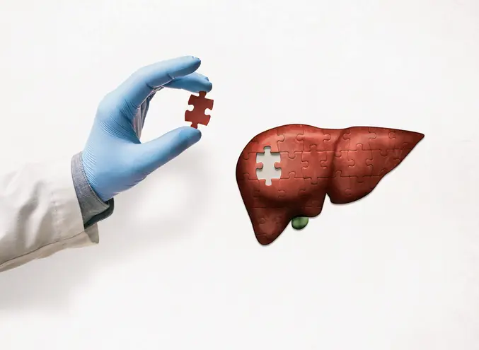 Orthotopic Liver Transplantation (OLT) Surgery
