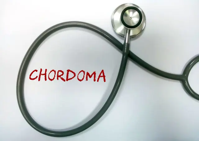 Chordoma Bone Tumor Treatment