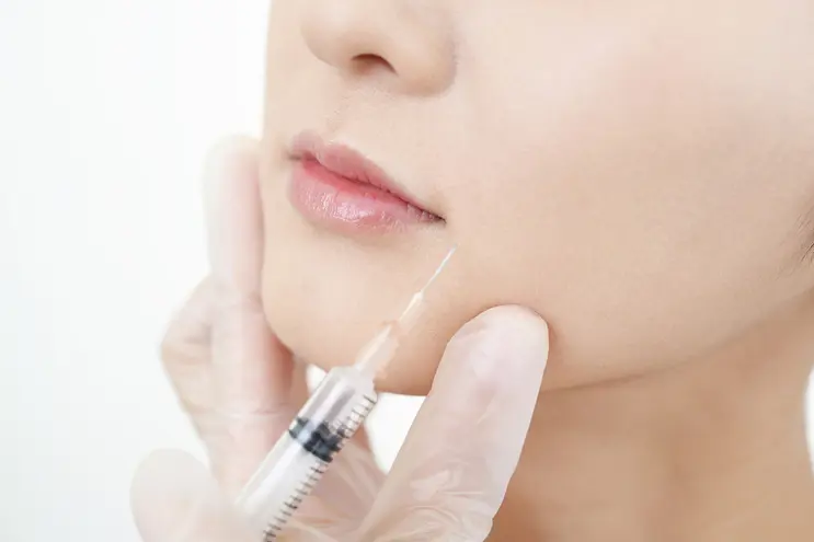 Reducción de mandíbula con Botox