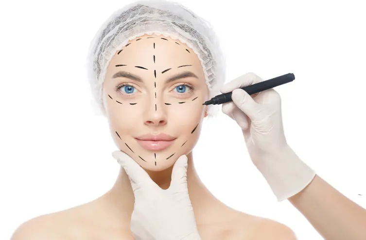 V-Line Chin Contouring Surgery