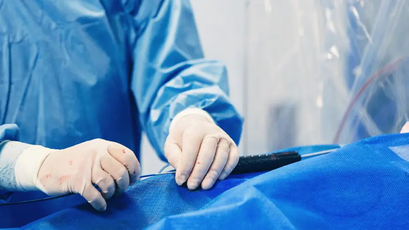 ICP (Intervención Coronaria Percutánea)