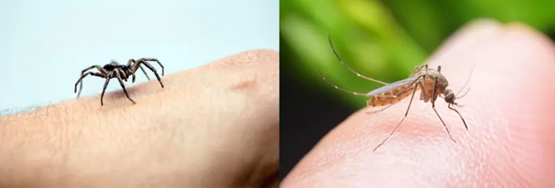 Spider Bites: What You Need to Know and When to Seek Treatment